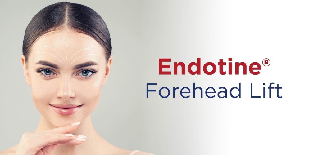 What is Endotine® Forehead Lift? - PPSI